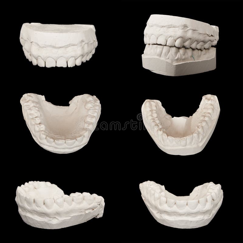 Gypsum Models Plaster Cast Stomatologic Human Jaws Stock Image - Image ...
