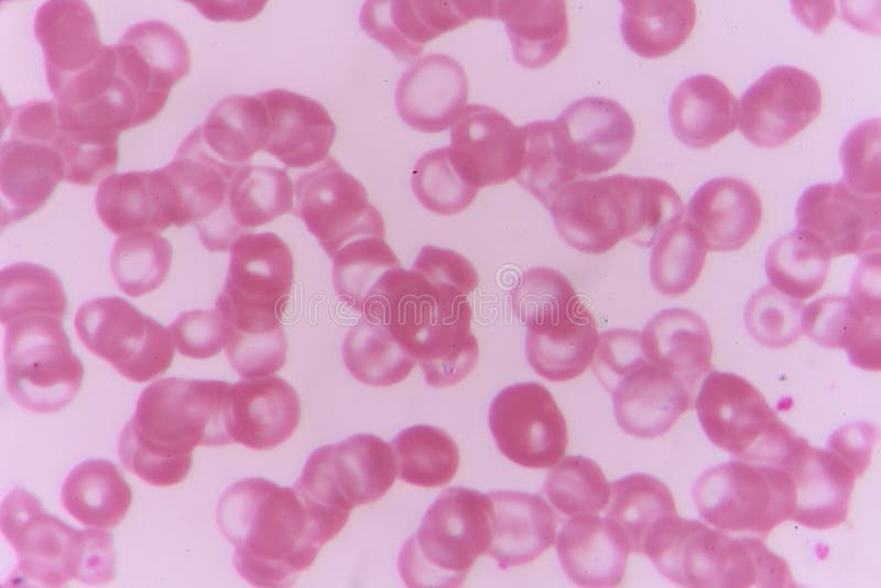 Hémogramme photo stock. Image du microscope, santé, sang - 60052672