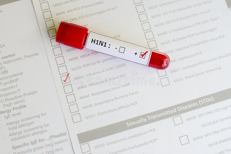 H1N1 Influenza positive stock image. Image of patient - 60216453