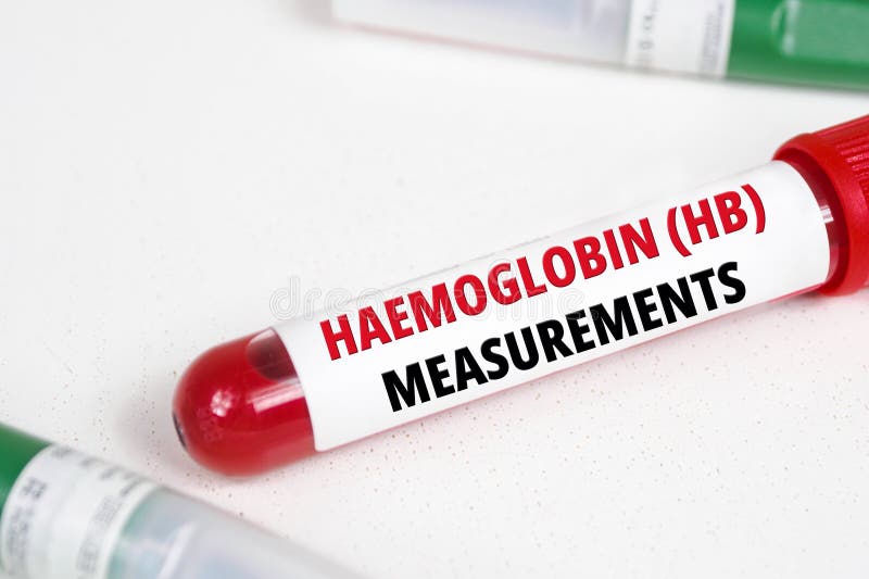 Haemoglobin (Hb) Measurements Title Text of Medical Analysis Stock ...