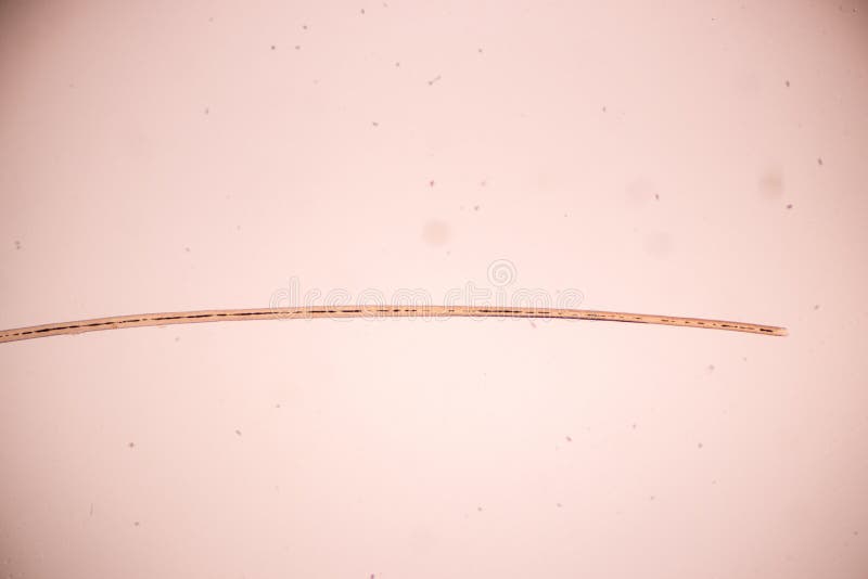 Hair Cell of Human Under Microscope View. Stock Image - Image of ...