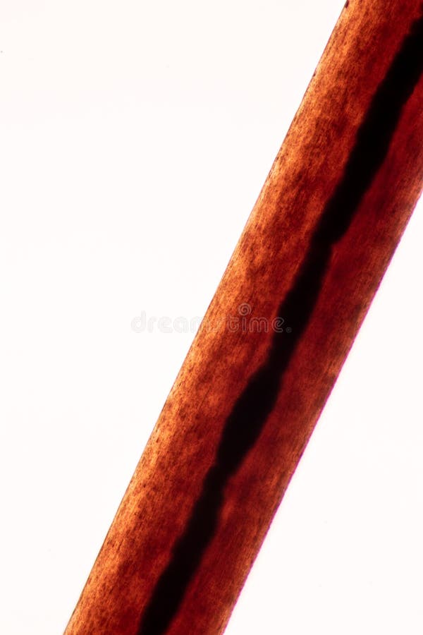 Hair Cell of Human Under Microscope View. Stock Photo - Image of ...