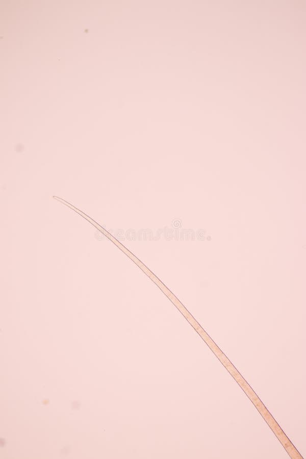 Hair Cell of Human Under Microscope View. Stock Image - Image of black ...
