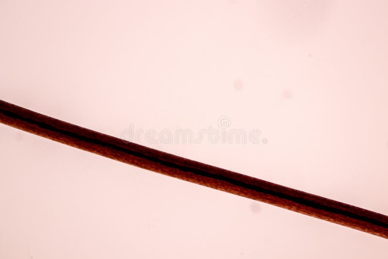 Hair Cell of Human Under Microscope View. Stock Photo - Image of care ...