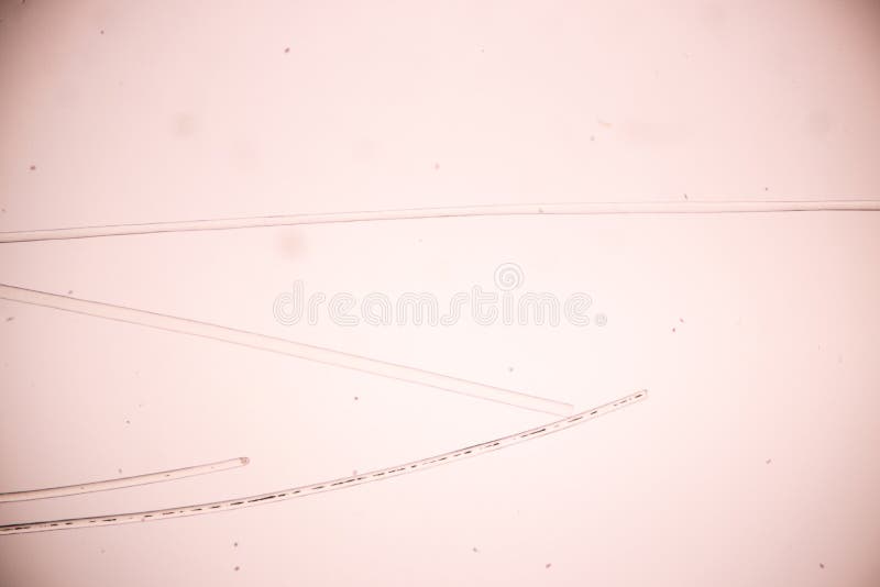 Hair Cell of Human Under Microscope View. Stock Photo - Image of ...
