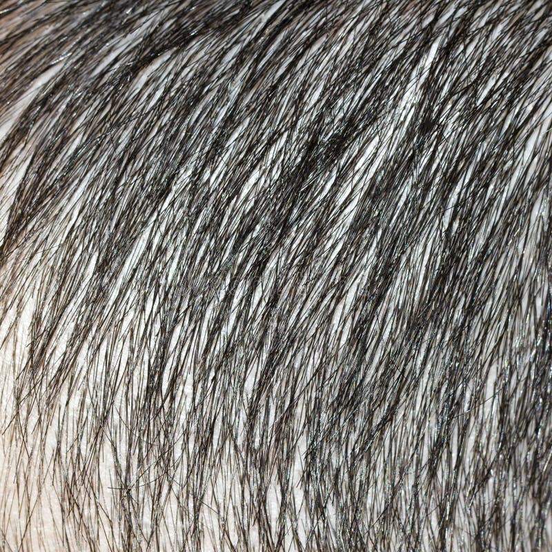 Human Skin Texture Scalp Stock Photos - Free & Royalty-Free Stock ...