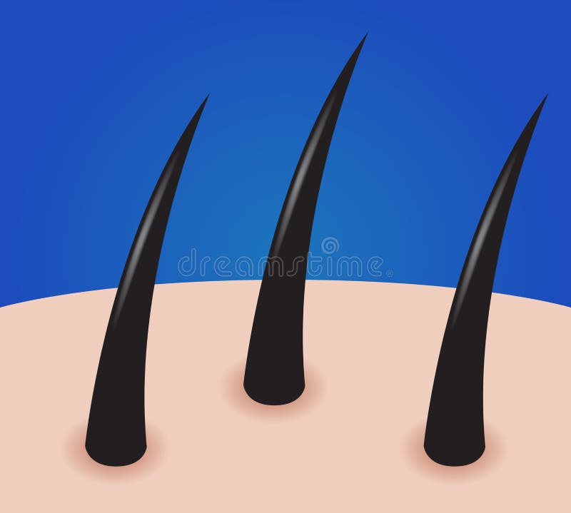 Scalp Graphic Stock Illustrations – 933 Scalp Graphic Stock ...