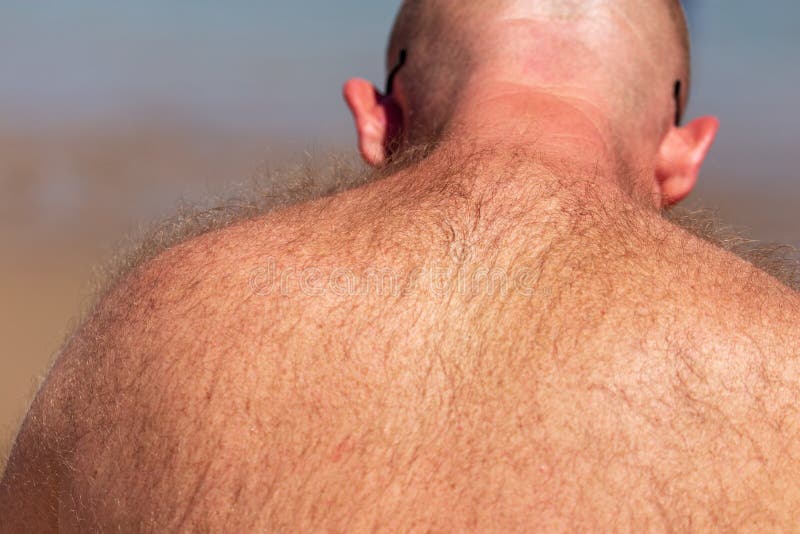 Hair Grows on the Back of a Man Stock Photo - Image of skin, male ...