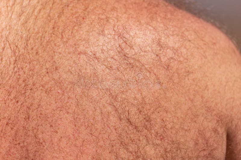 Hair Grows on the Back of a Man Stock Photo - Image of young, white ...