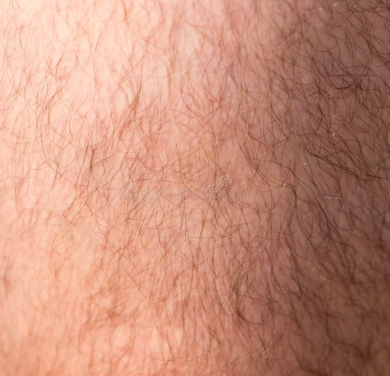 Body Hair of a Man. Overgrown Body Hair of a Man. Overgrown Skin Stock ...