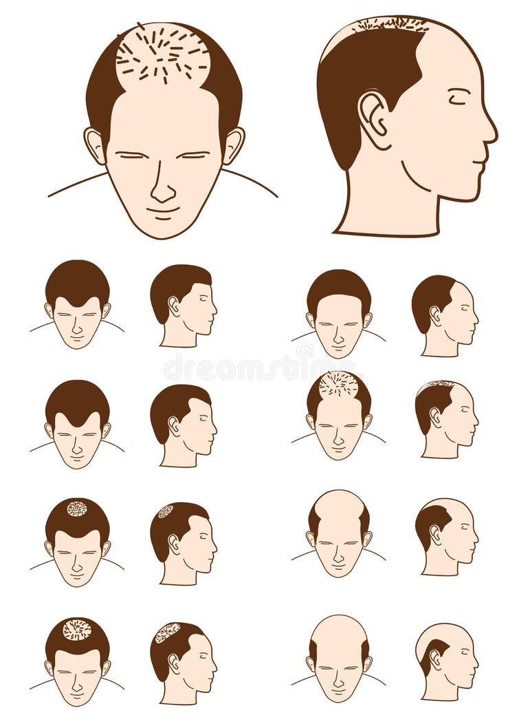 Clinical Hair Stock Illustrations – 1,408 Clinical Hair Stock ...