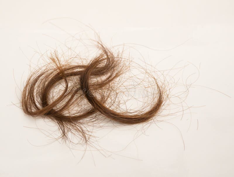 Hair Loss Problem, Hair Loss Problem, Hair Loss Problem. Stock Photo ...