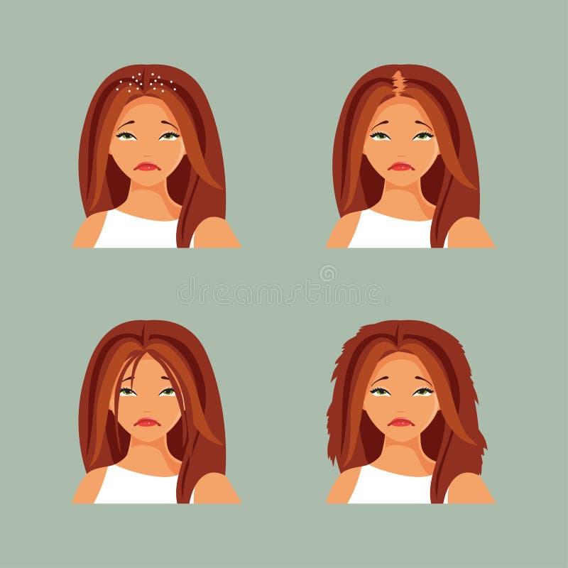 Dandruff Cartoon Stock Illustrations – 100 Dandruff Cartoon Stock ...