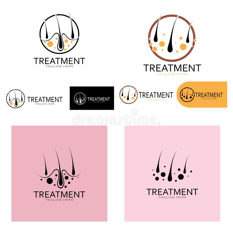 Hair Treatment Logo Hair Transplantation Logo,removal Logo Vector Image ...