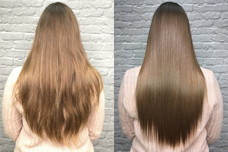 Hair before and after Treatment. Stock Photo - Image of collage ...
