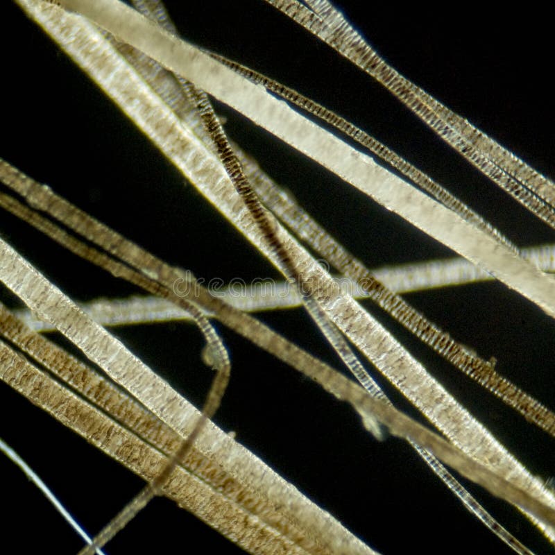 Hair Cells Under A Microscope