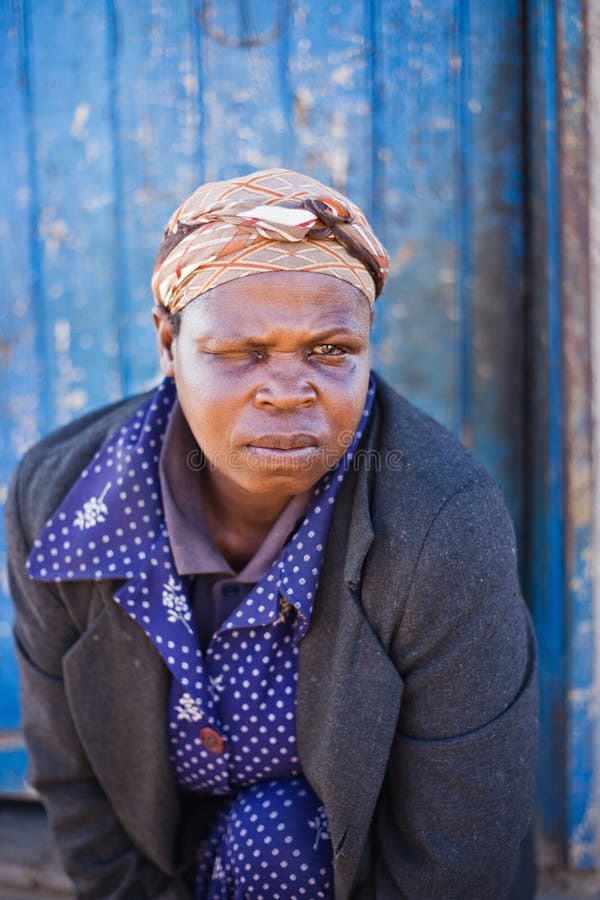Half blind woman stock photo. Image of dress, female, outdoors - 6743288