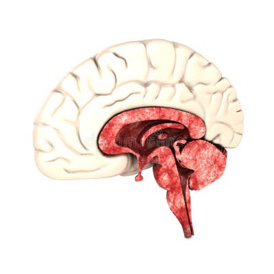 Half brain stock illustration. Illustration of illness - 5704696