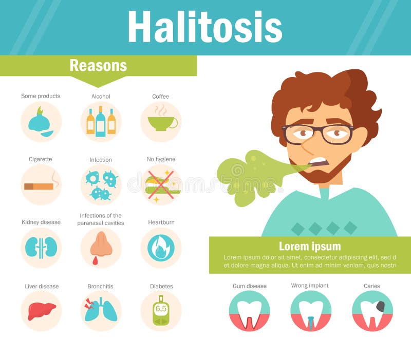 Carie. Odeur De La Bouche. Mauvaise Haleine. La Structure Des Dents Et ...
