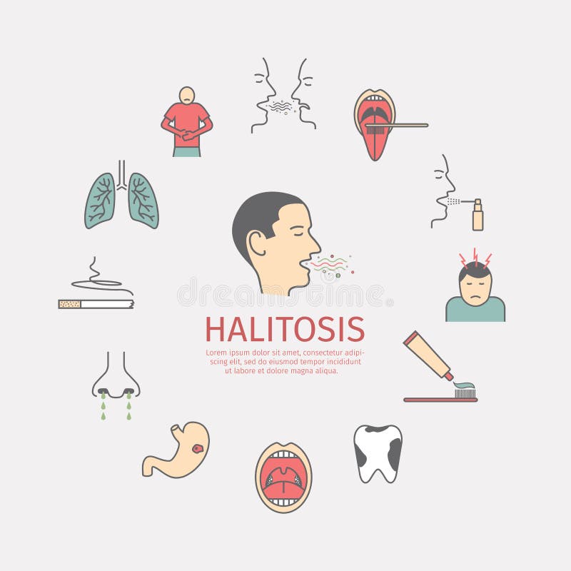Halitose. Symptomen, Behandeling. Set Van Lijniconen Vector Illustratie ...