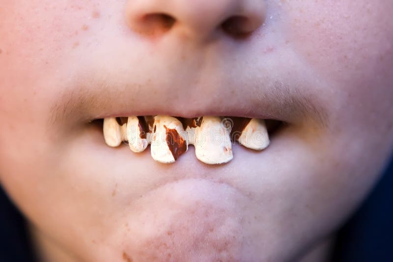 454 Scary Face Bad Teeth Stock Photos - Free & Royalty-Free Stock ...
