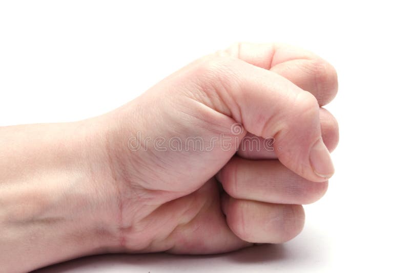 Redness and Callus or Corn on the Wrist of a Caucasian Woman`s Hand ...