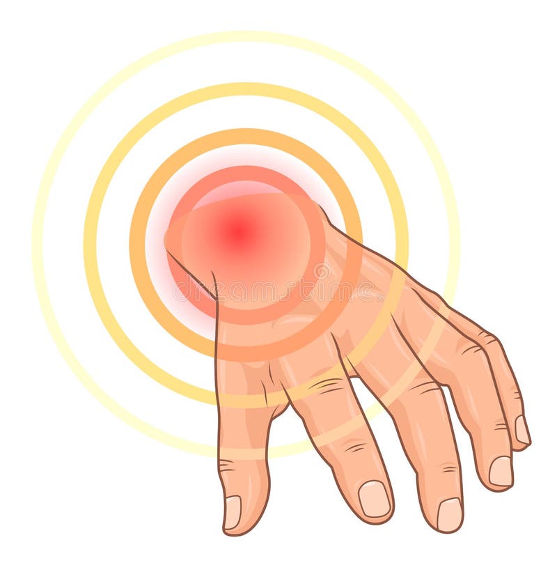 Hurt Hand Stock Illustrations – 5,183 Hurt Hand Stock Illustrations ...