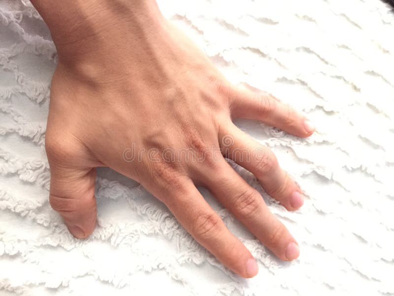Aching Fingers Stock Images - Download 151 Royalty Free Photos