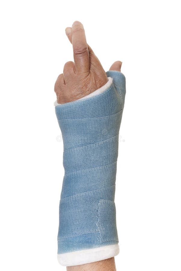 Hand And Arm In Cast With Fingers Crossed Stock Photo - Image of luck ...