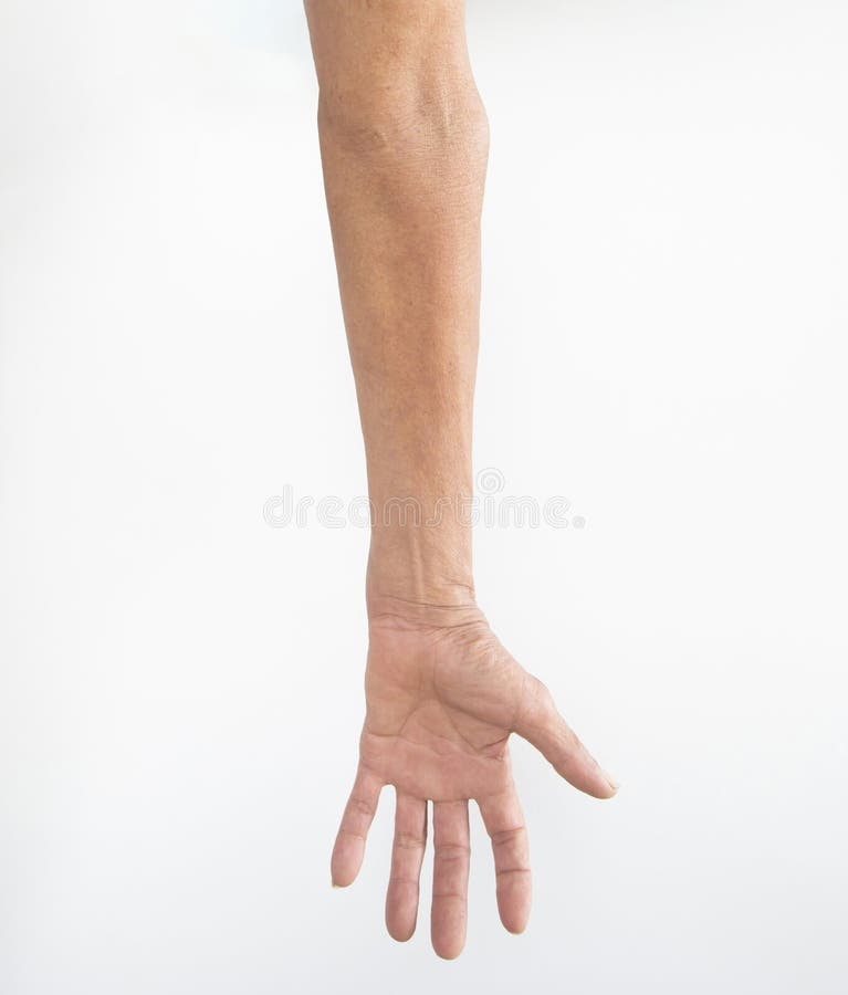 Hand and Arm of an Elderly Person Stock Image - Image of attend, harm ...
