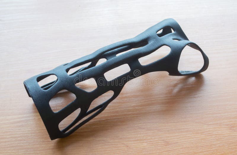 Hand Arm Splint Corset Prosthesis Printed 3D Printer Molten Plastic on ...