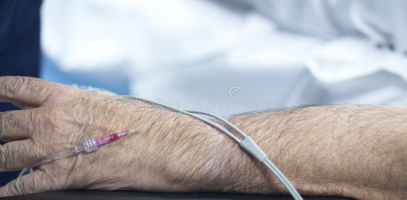 Hand and Arm Surgery Orthopedics Operation Stock Photo - Image of ...