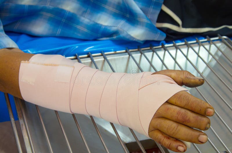 Hand bandage. stock image. Image of health, human, patient - 43444589