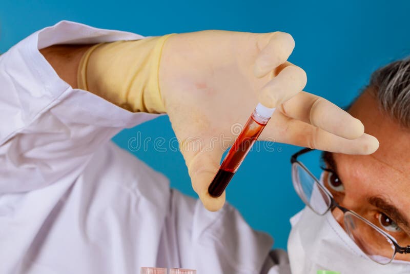 A Hand a Blood Sample Tube Scientist in Research Lab Stock Image ...