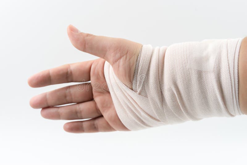 Hand Bone Broken From Accident With Arm Splint. Stock Photo - Image of ...