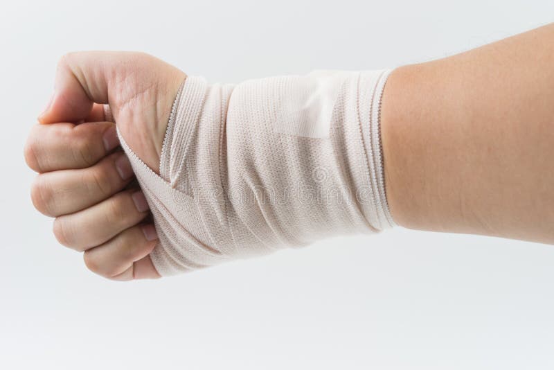 Hand Bone Broken from Accident with Arm Splint Stock Photo - Image of ...