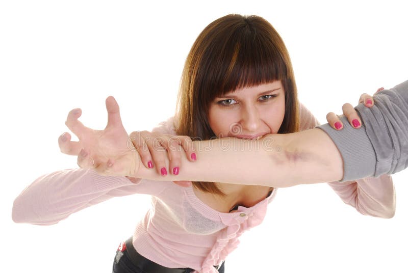 Hand with bruise stock image. Image of medicine, girl - 4103865