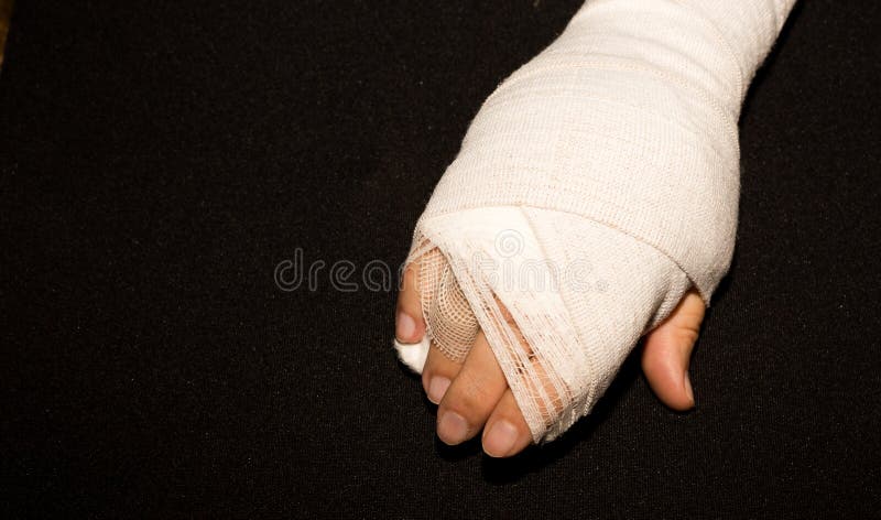 Hand in a cast. stock photo. Image of medical, operation - 92930368