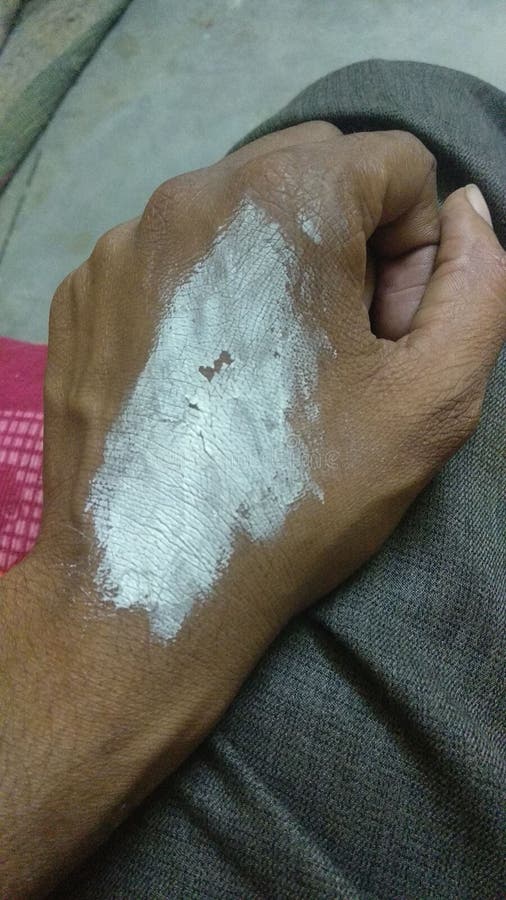 Hand chot stock photo. Image of green, sweet, tree, hand - 132177234