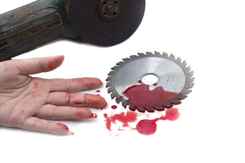 Hand and Circular Saw Disc Bloody on White Background, Safety First ...