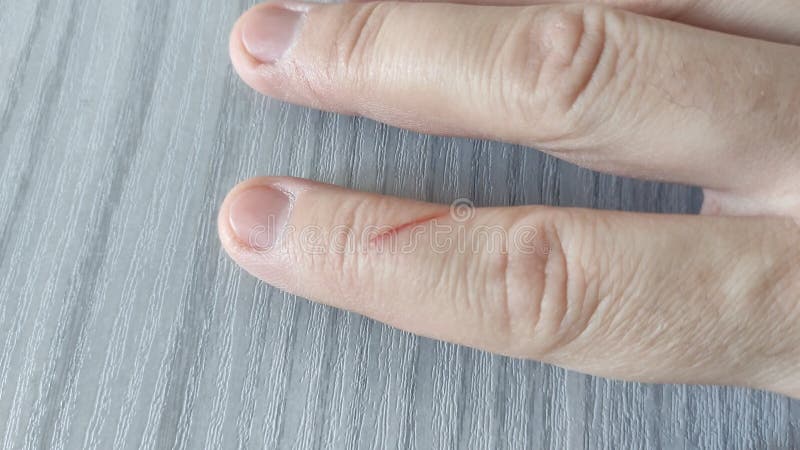Bleeding from Finger Cut with Kitchen Knife Stock Footage - Video of ...