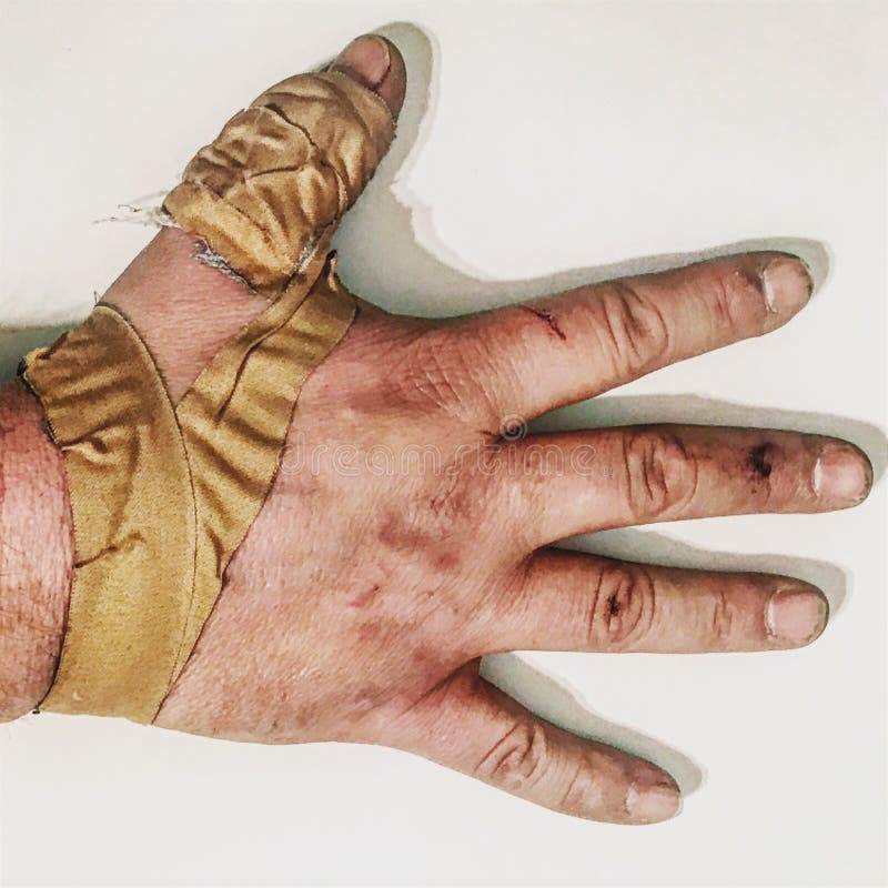 Hand cut stock photo. Image of propeller, accident, hand - 84743648