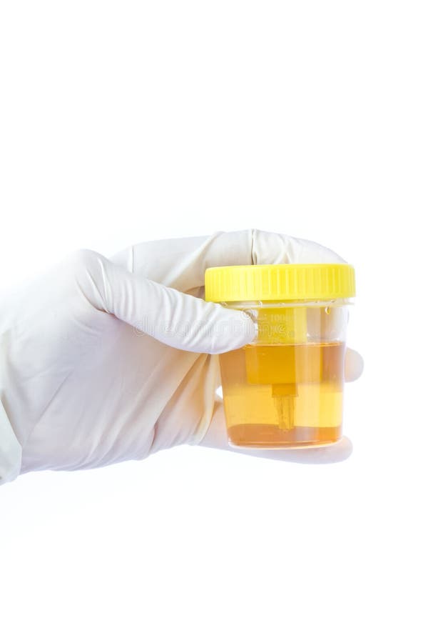 Urinprobe Auf Einer Laborform Stockfoto - Bild von kontrolle ...