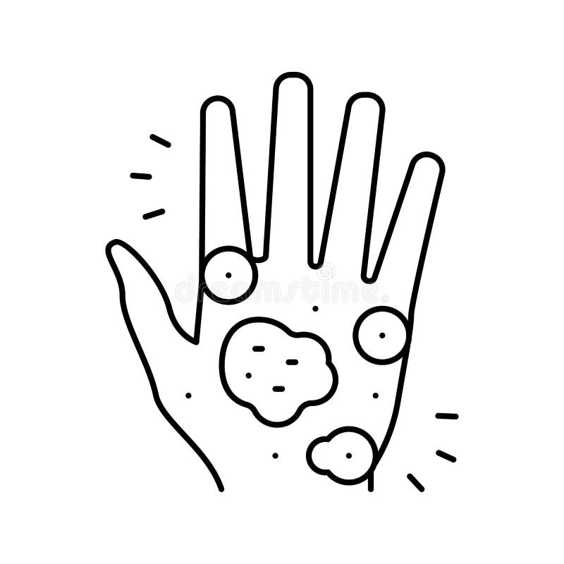Hand Eczema Line Icon Vector Illustration Stock Vector Illustration Of Outline