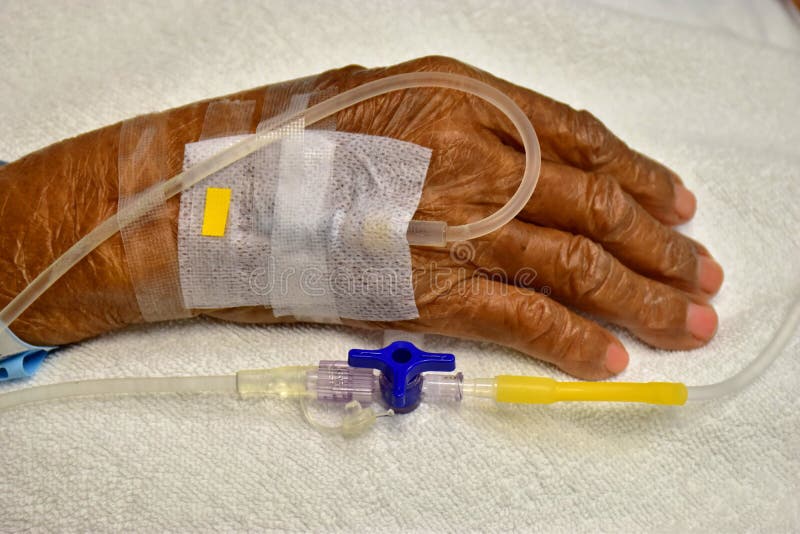 Hand elderly with IV drip. stock photo. Image of admit - 86385798