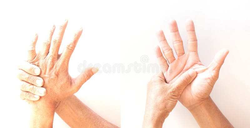 Hand and Finger of Elderly People with Muscle Problem Stock Photo ...