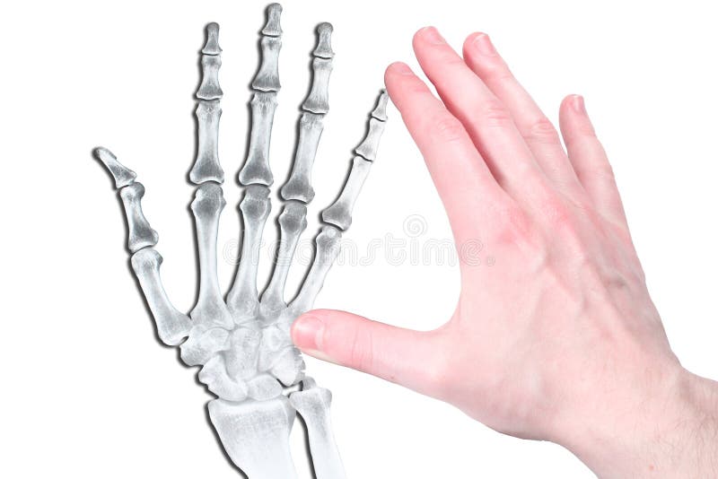 Hand in flash and bone stock photo. Image of equivalent - 19158102