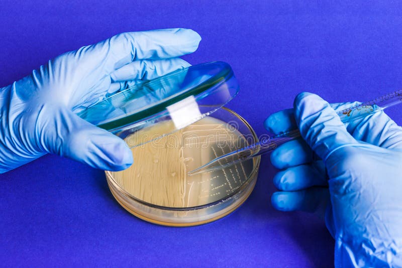 Hand in Glove Holding the Petri Dish with Bacteria, Work in Biochemical ...