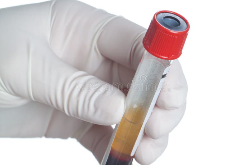 Hand in Glove with Blood Tube Stock Image - Image of medicine, biology ...