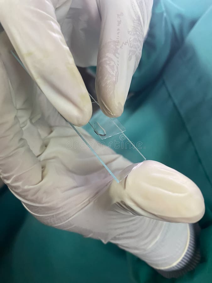 Hand in Glove in Laboratory Analyzing the Samples Stock Image - Image ...